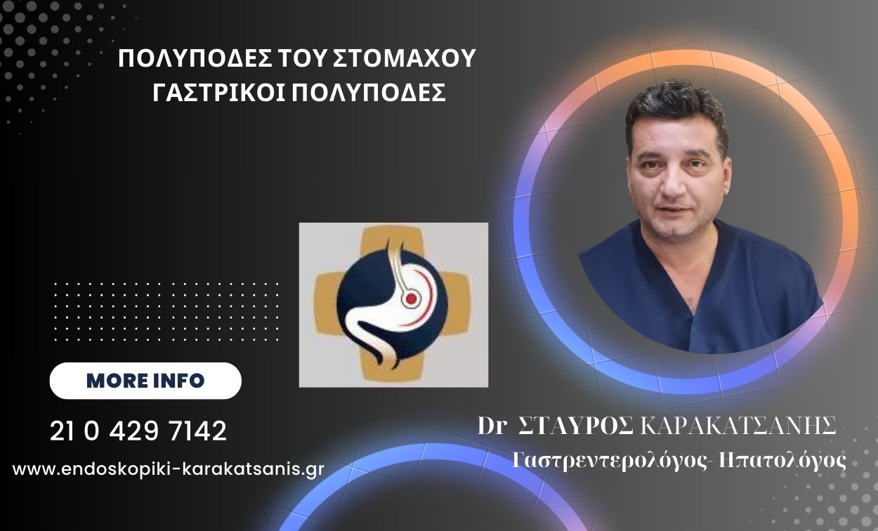 Πολύποδες στομάχου ή Γαστρικοί πολύποδες: Διάγνωση και Θεραπεία ...